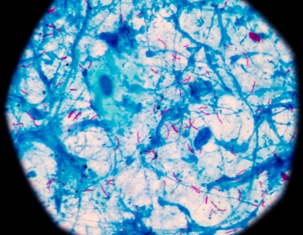 Compounds demonstrate promising activity against tuberculosis ...