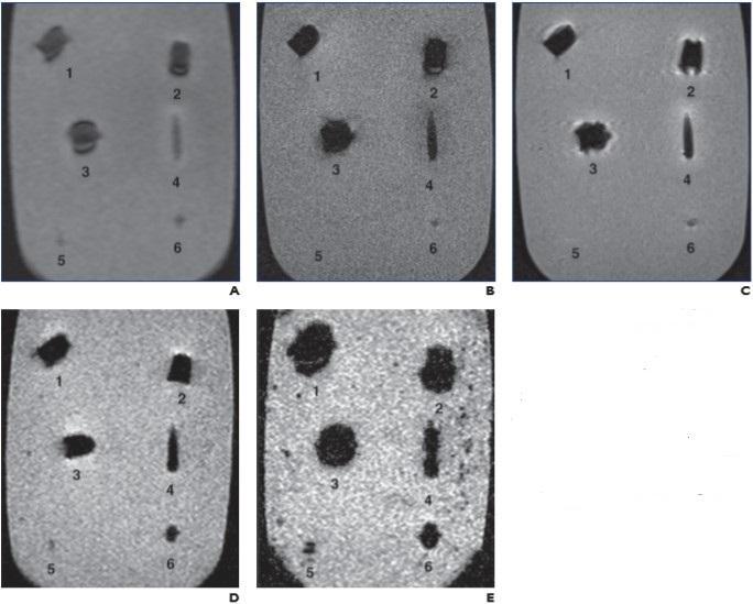 Imaging of ballistic wounds, bullet composition and implications for ...