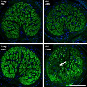 Retinal Aging Accelerated by Stress - American Biotech News