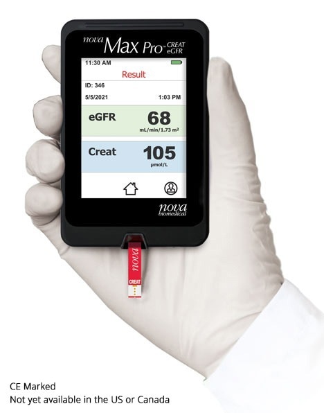 Nova Biomedical Launches CE-Marked Nova Max Pro Creatinine/eGFR Meter ...