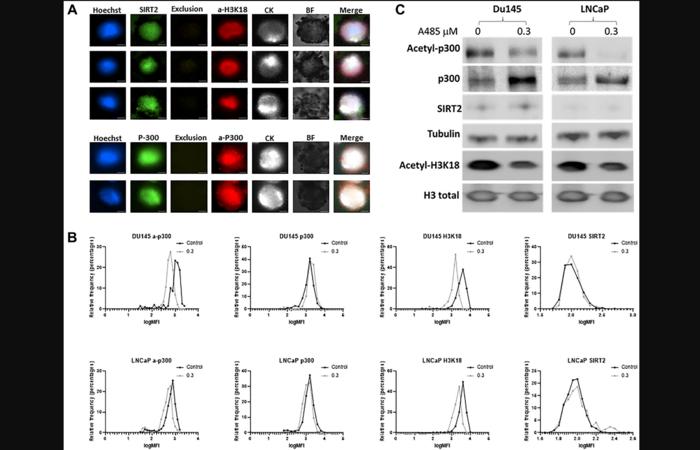 A multiplex assay to assess activated p300/CBP in circulating prostate ...
