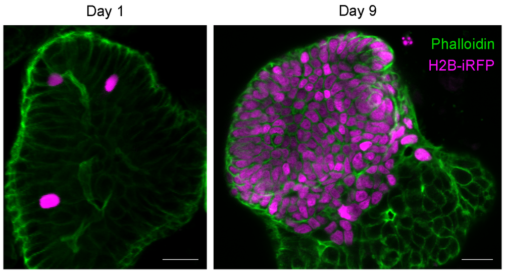 Intestinal Organoids Reveal Tuft Cells’ Role in Regeneration - American ...