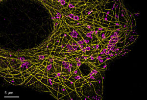 Super-Resolution Microscopy More Than Pretty Pictures - American ...
